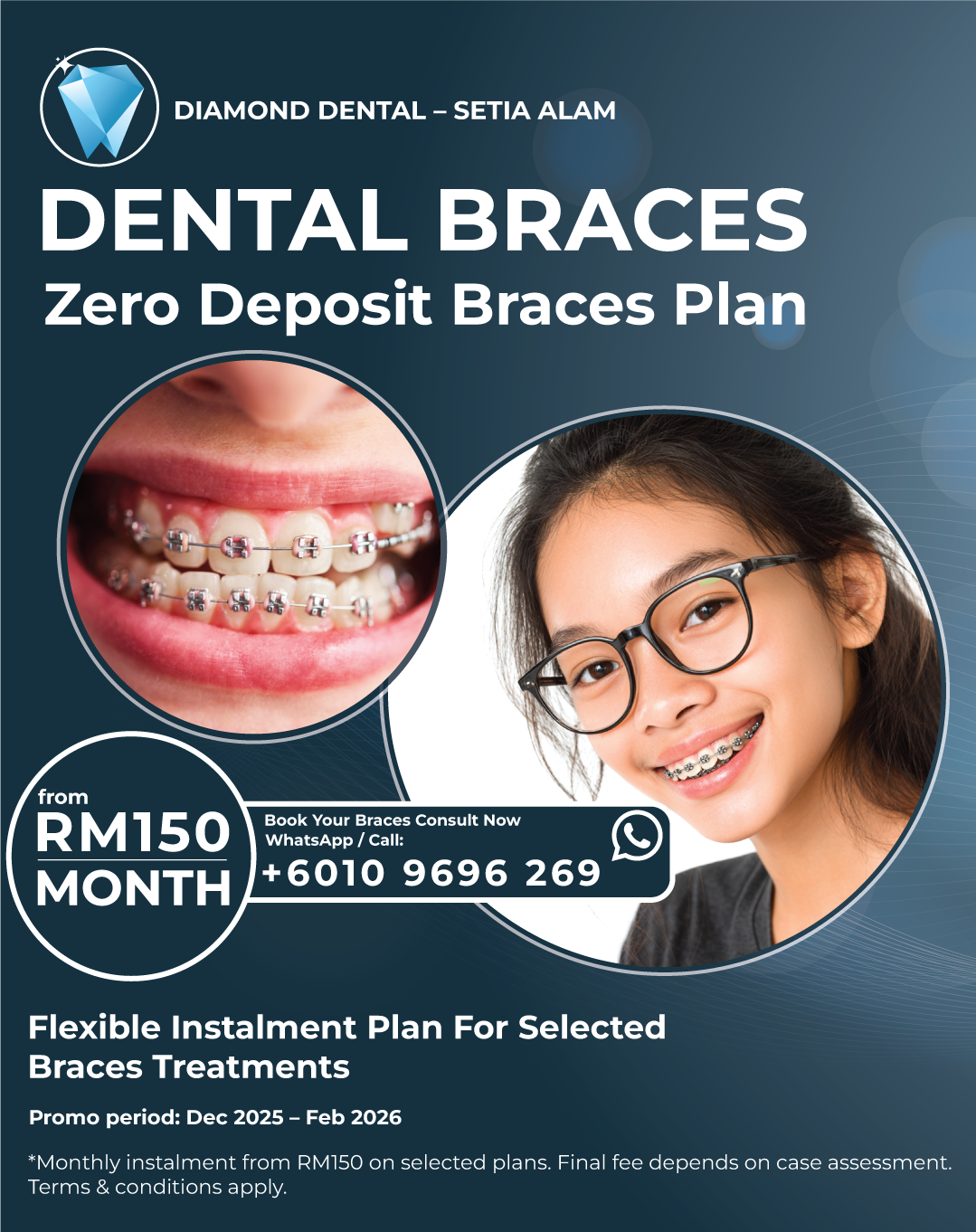 Zero Deposit Dental Braces in Setia Alam | From RM150/Month